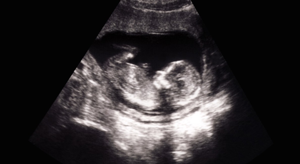 ‘Transgender’ surgery results in tragic death of preborn child | Live ...