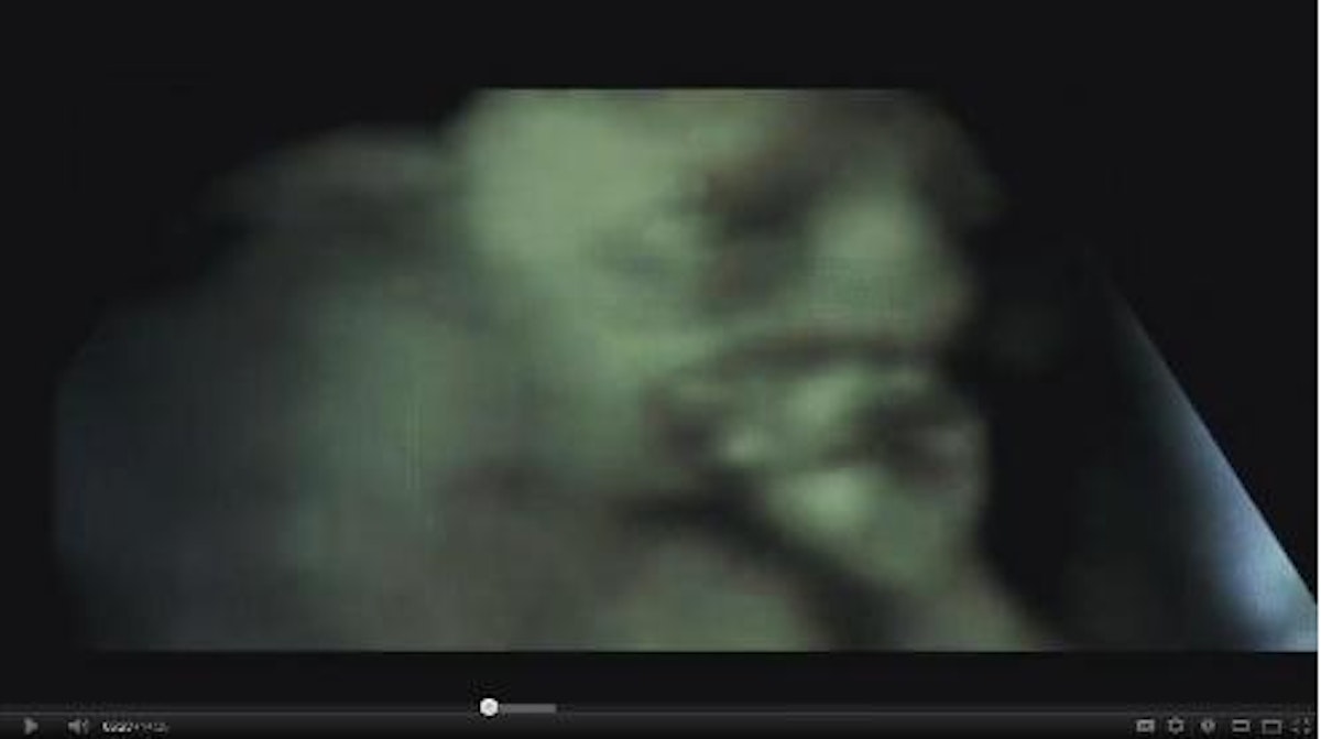 Live birth abortion trial: the story of Dr. Kenneth Edelin | Live Action