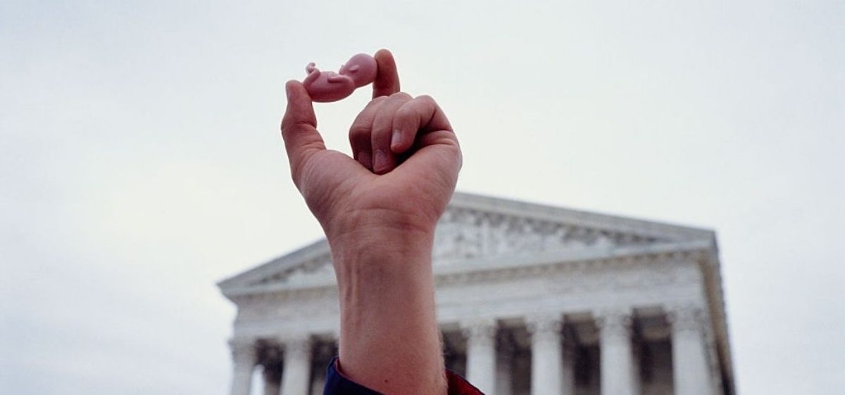 The Supreme Court declines to hear case regarding personhood of preborn ...