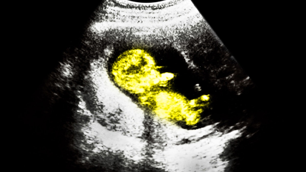 5 amazing things preborn children can do inside the womb | Live Action