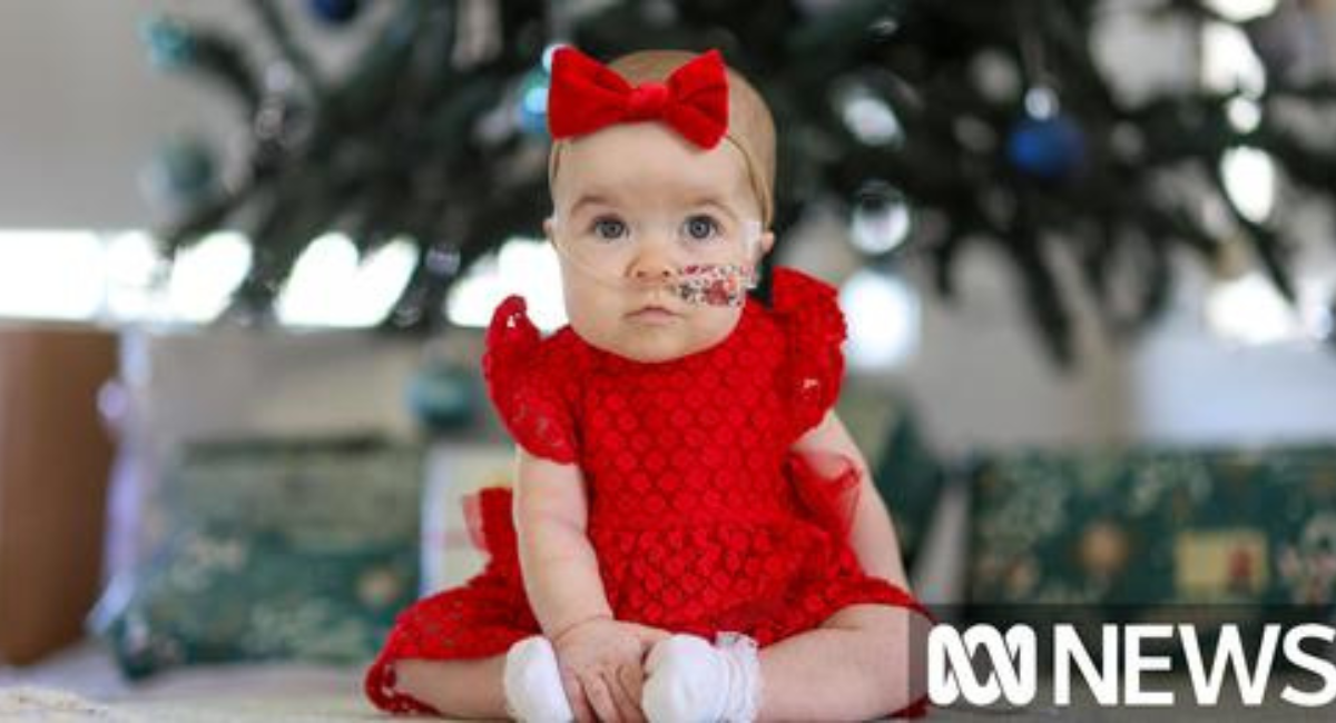 Baby born with organs outside her body celebrated her first Christmas ...