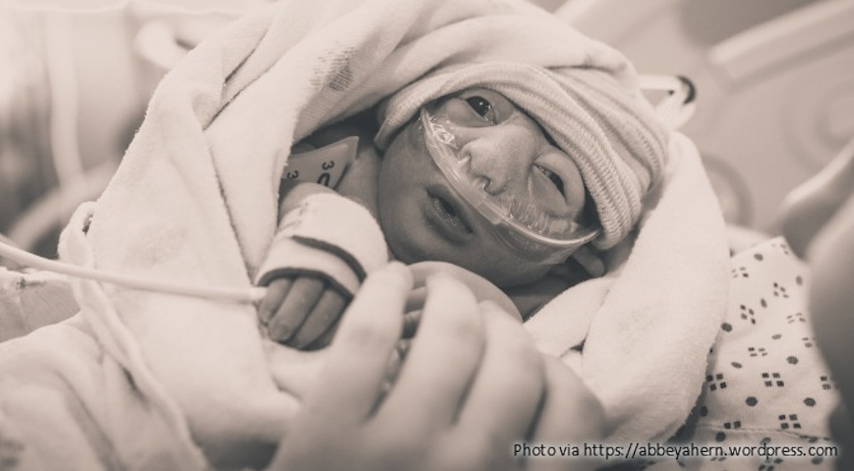 Baby with anencephaly inspires a movement of kindness | Live Action