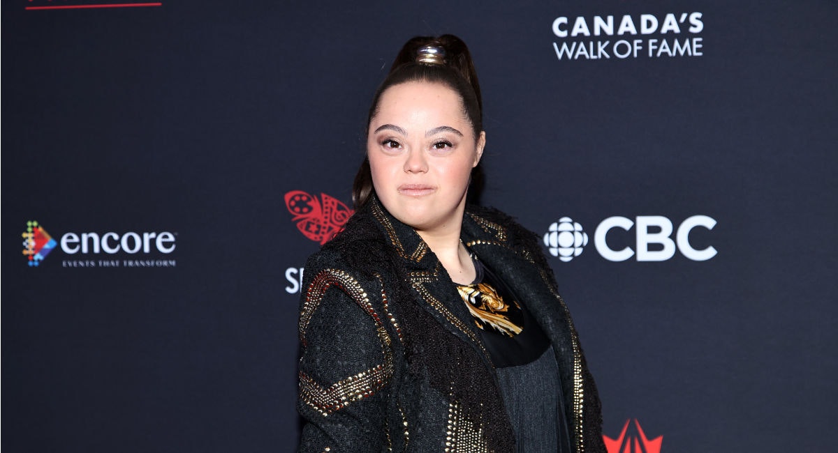 Model with Down syndrome stars in ‘coming-of-age romantic comedy ...