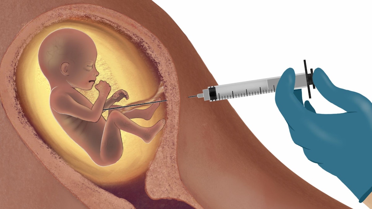 OPINION: Is lethal injection of a preborn child 'modern healthcare ...