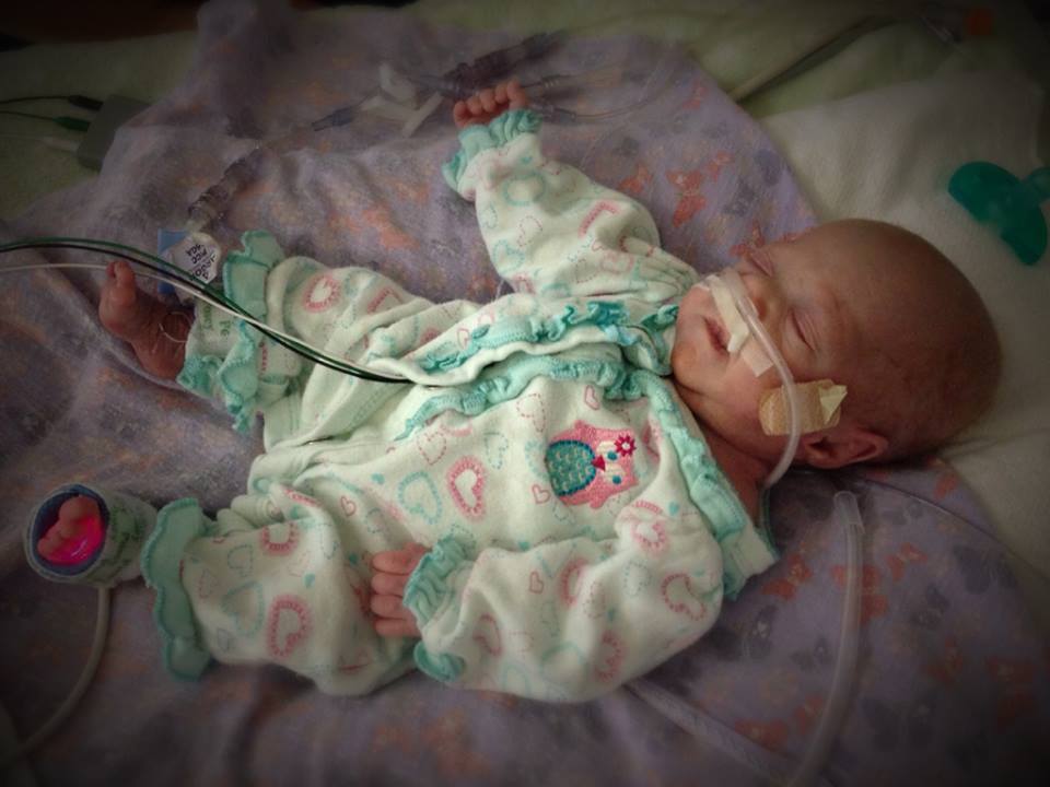 Miracle baby, born premature at 25 weeks, is beating the odds Miracle baby, born premature at 25 weeks, is beating the odds